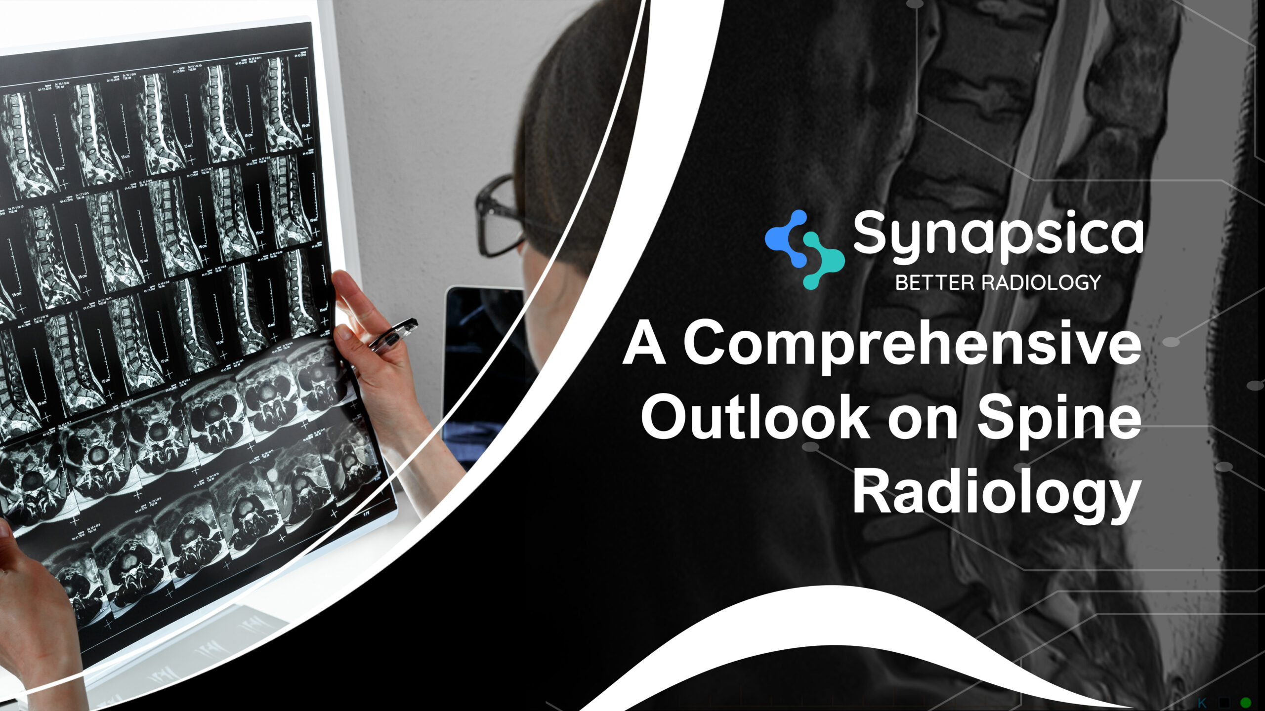 Spine Radiology: An Overview | Synapsica